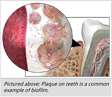 Understanding Biofilm and Lyme Disease - Lyme-int - Lyme disease worldwide