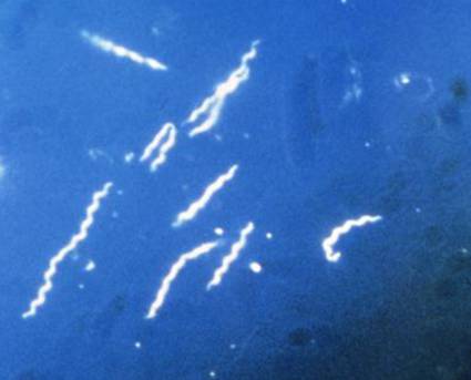 Metamorphoses of Lyme disease spirochetes : phenomenon of Borrelia ...